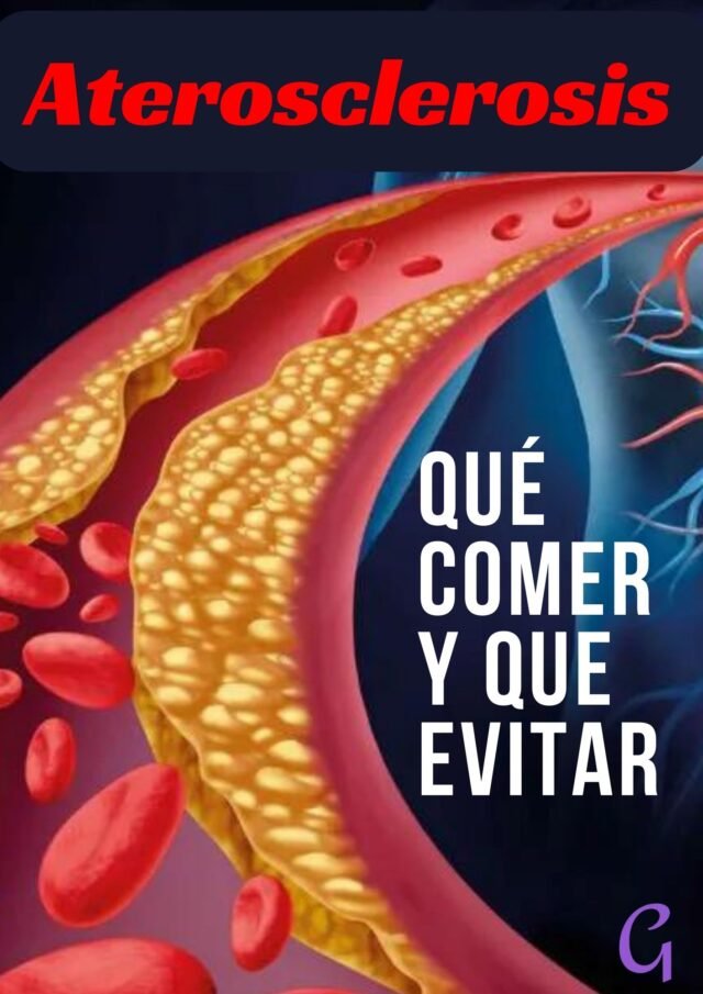 Qué comer y que evitar si tienes aterosclerosis. - Guía Femenina
